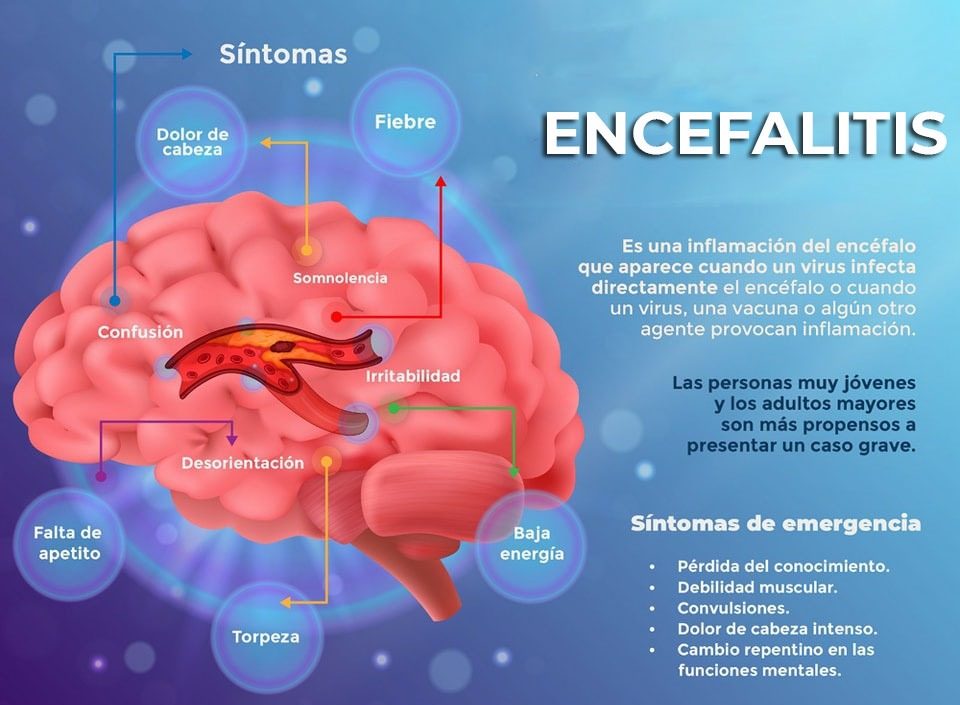 Estos son los síntomas de la encefalitis; enfermedad curable, si se ...